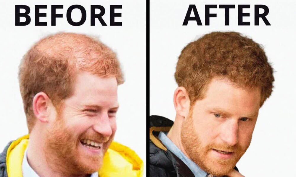 Prince Harry’s Hair Transformation Over the Years: A Closer Look – News ...